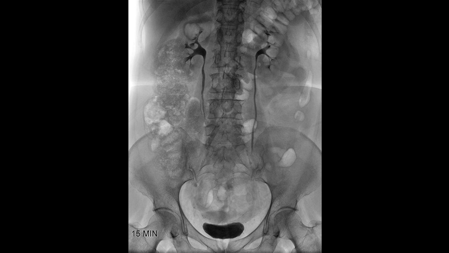 Urology device Uroskop Omnia Max