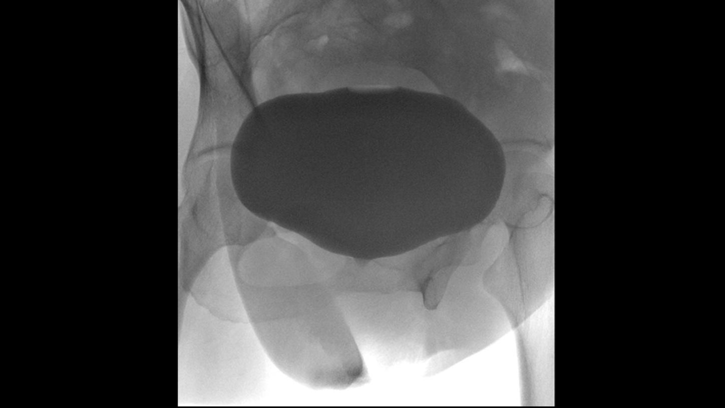 Urology device Uroskop Omnia Max