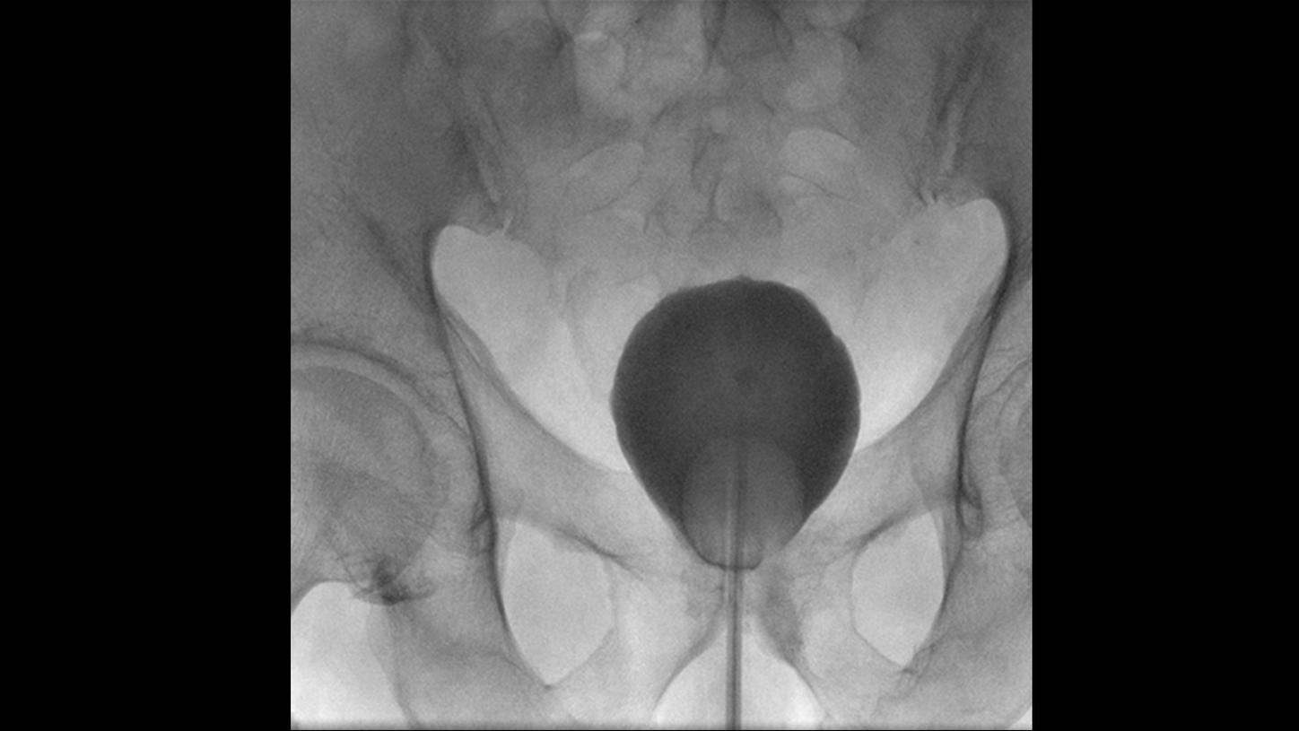 Urology device Uroskop Omnia Max