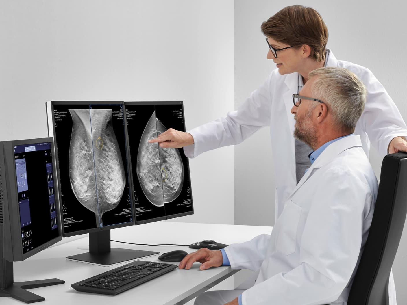 High Definition Breast Tomosynthesis