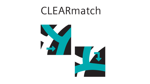 CARE+CLEAR in Interventional Imaging