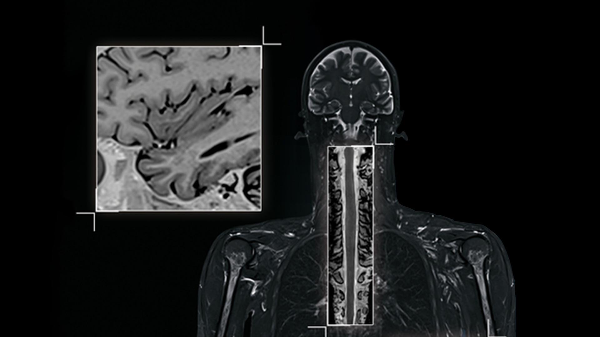 MAGNETOM Prisma - MRI Scanner