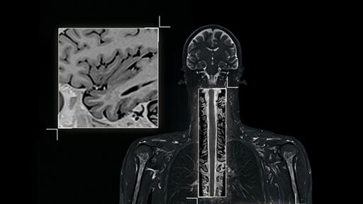 MAGNETOM Prisma - MRI Scanner