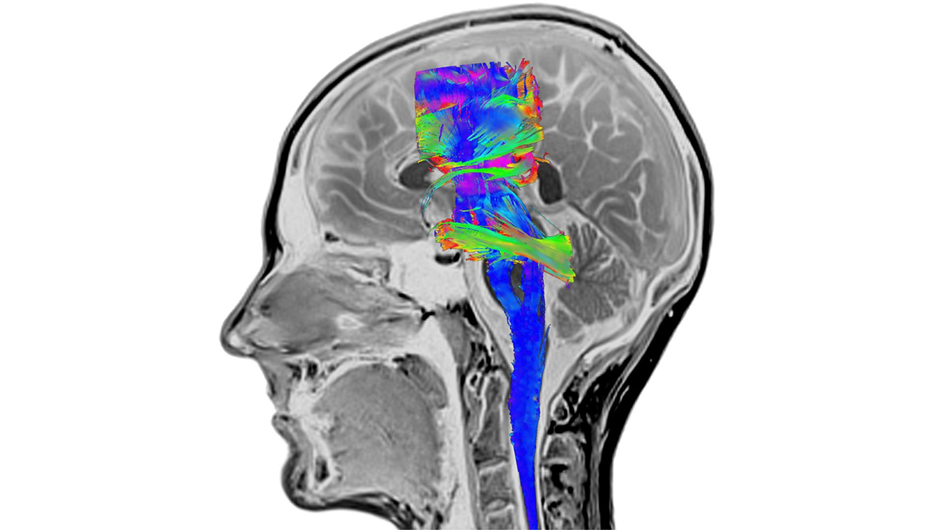 MAGNETOM Prisma - MRI Scanner
