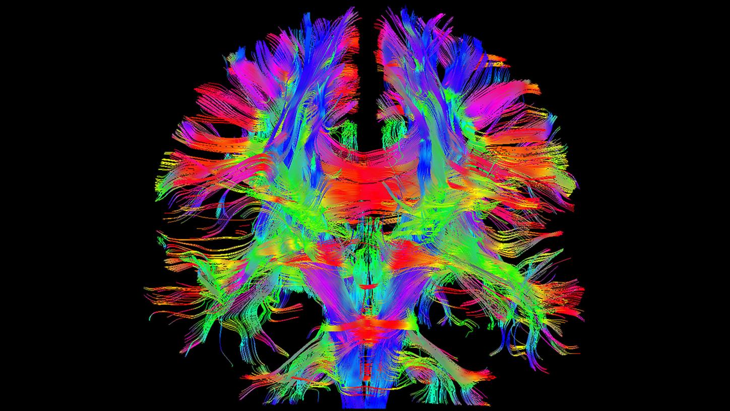 MAGNETOM Prisma - MRI Scanner