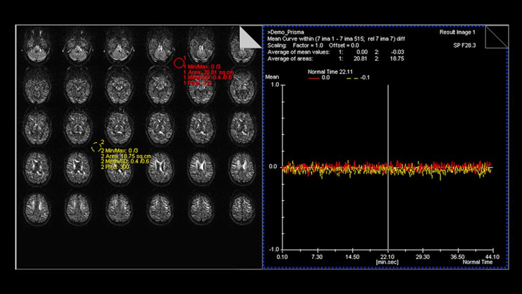 MAGNETOM Prisma - MRI Scanner