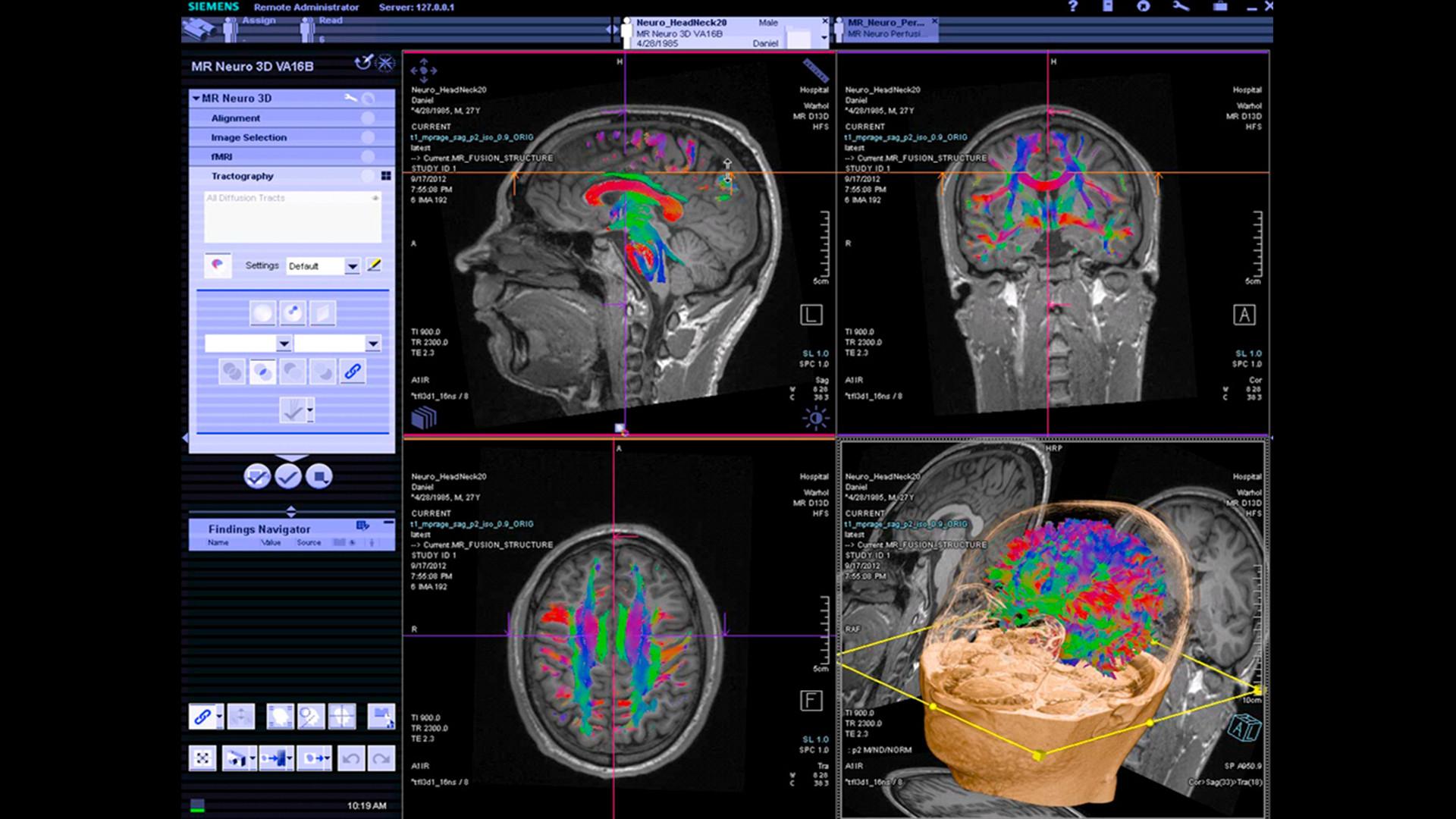 MAGNETOM Prisma - MRI Scanner