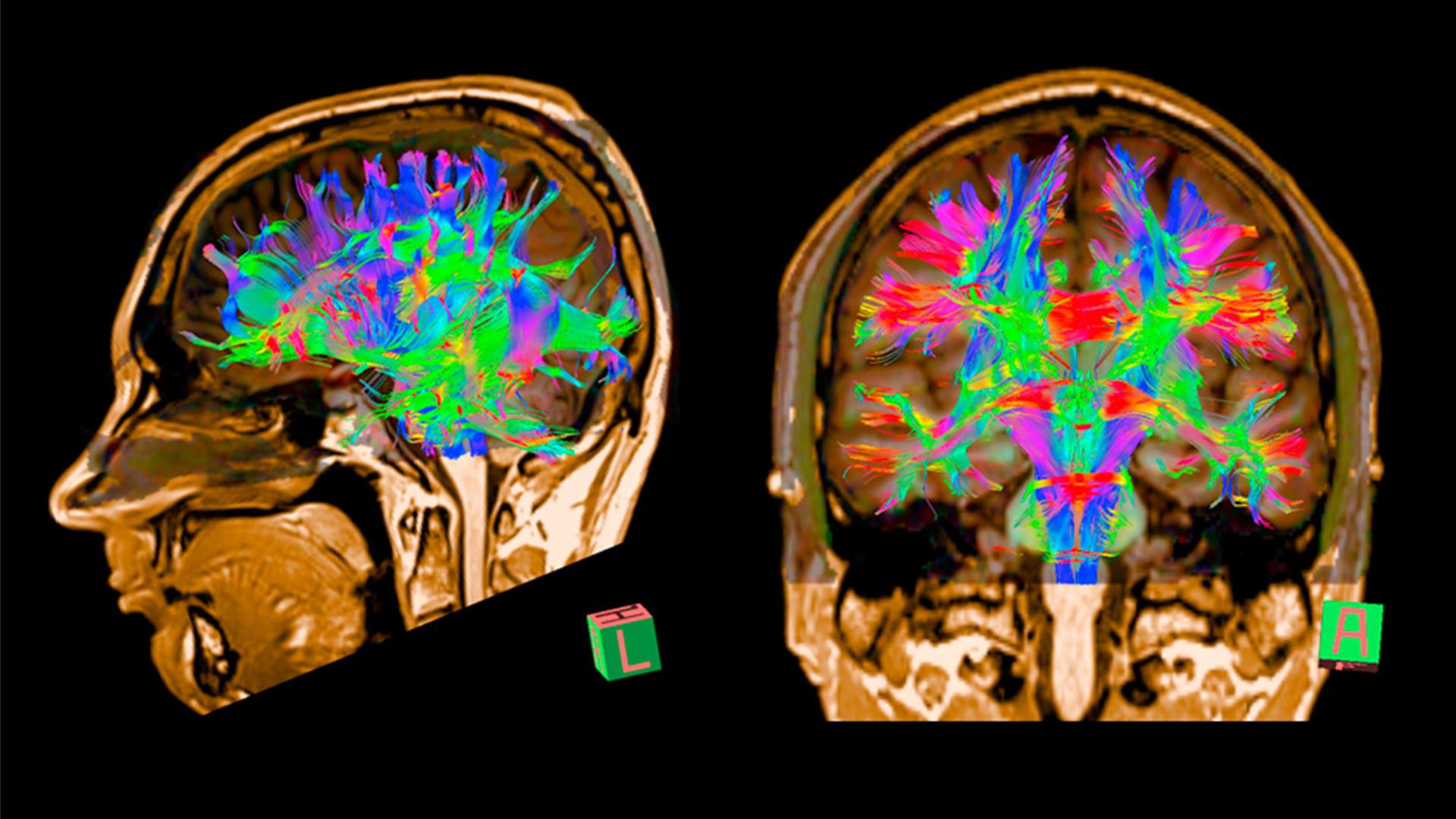 MAGNETOM Prisma - MRI Scanner