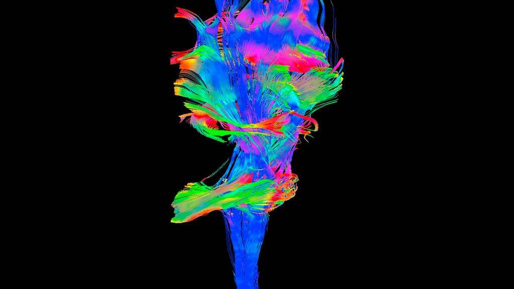MAGNETOM Prisma - MRI Scanner