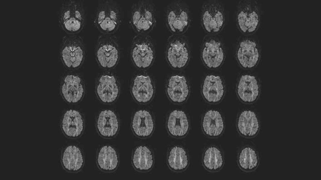MAGNETOM Prisma - MRI Scanner