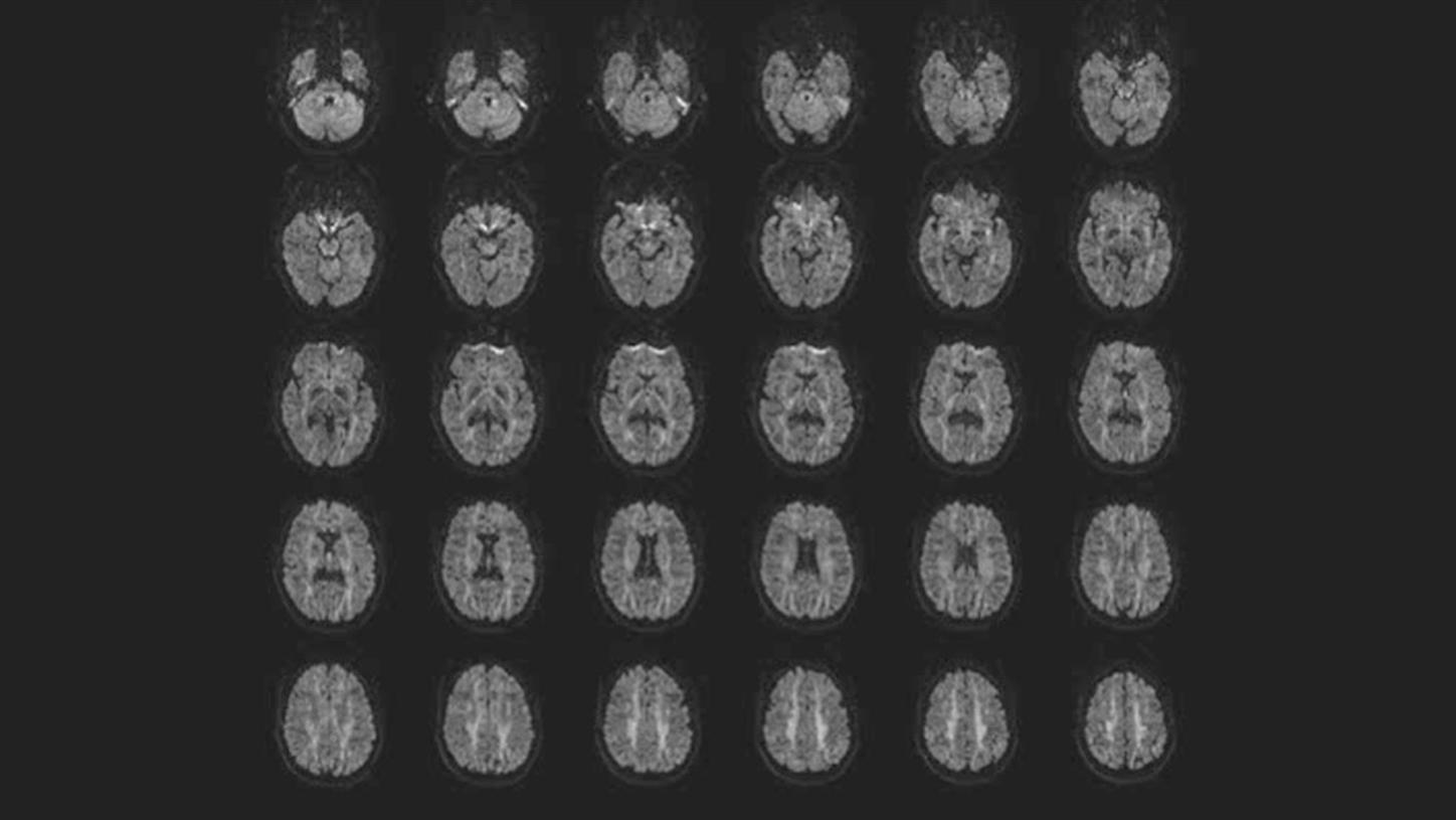 MAGNETOM Prisma - MRI Scanner