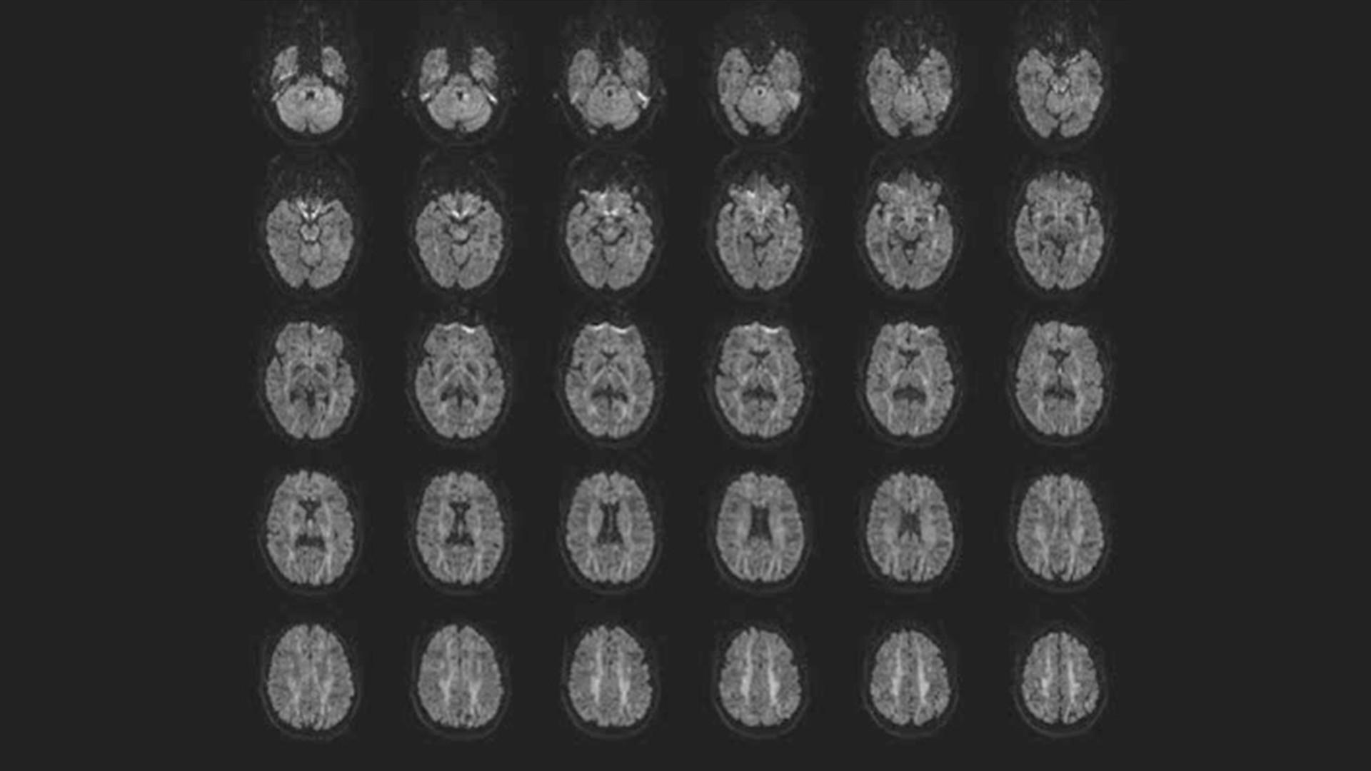 MAGNETOM Prisma - MRI Scanner