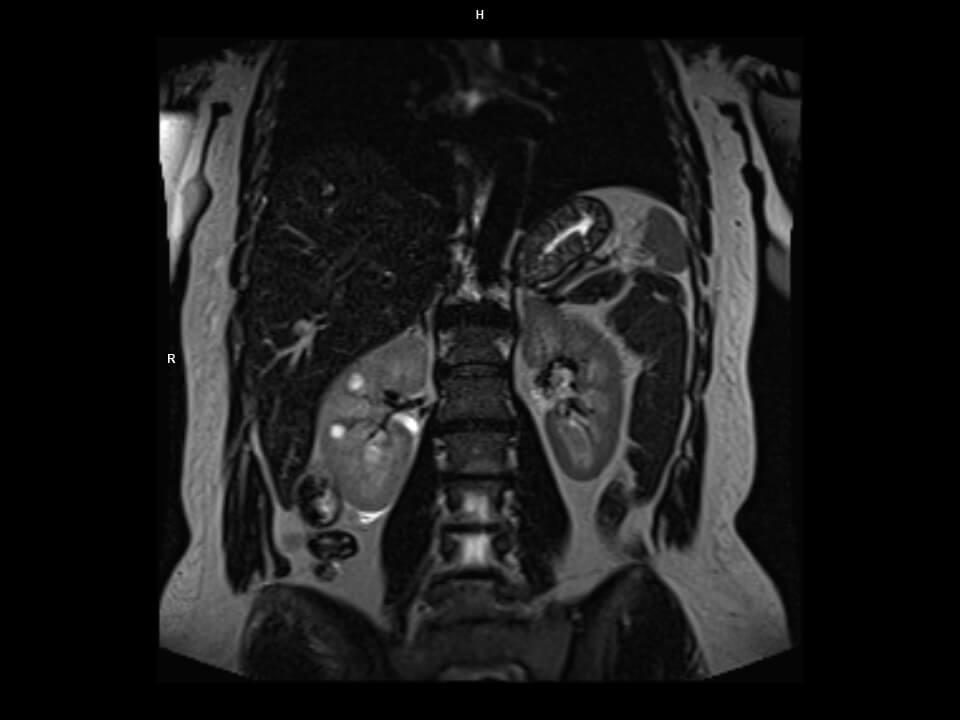 Magnetic Resonance Imaging – Clinical Media (Images, Video)