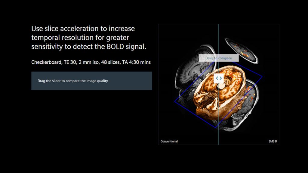 MR Neuro Imaging - MRI Neurology