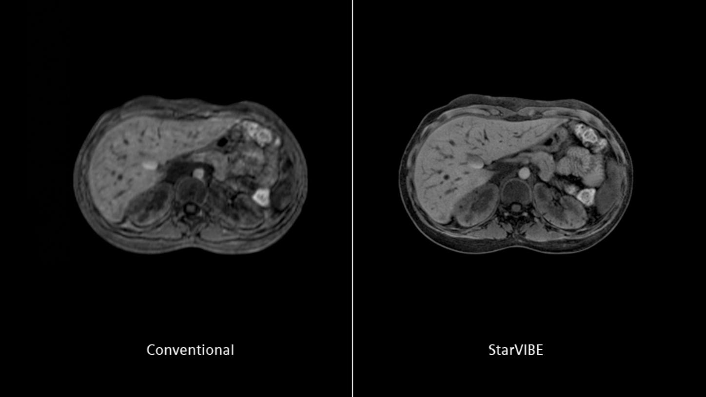 Body MRI
