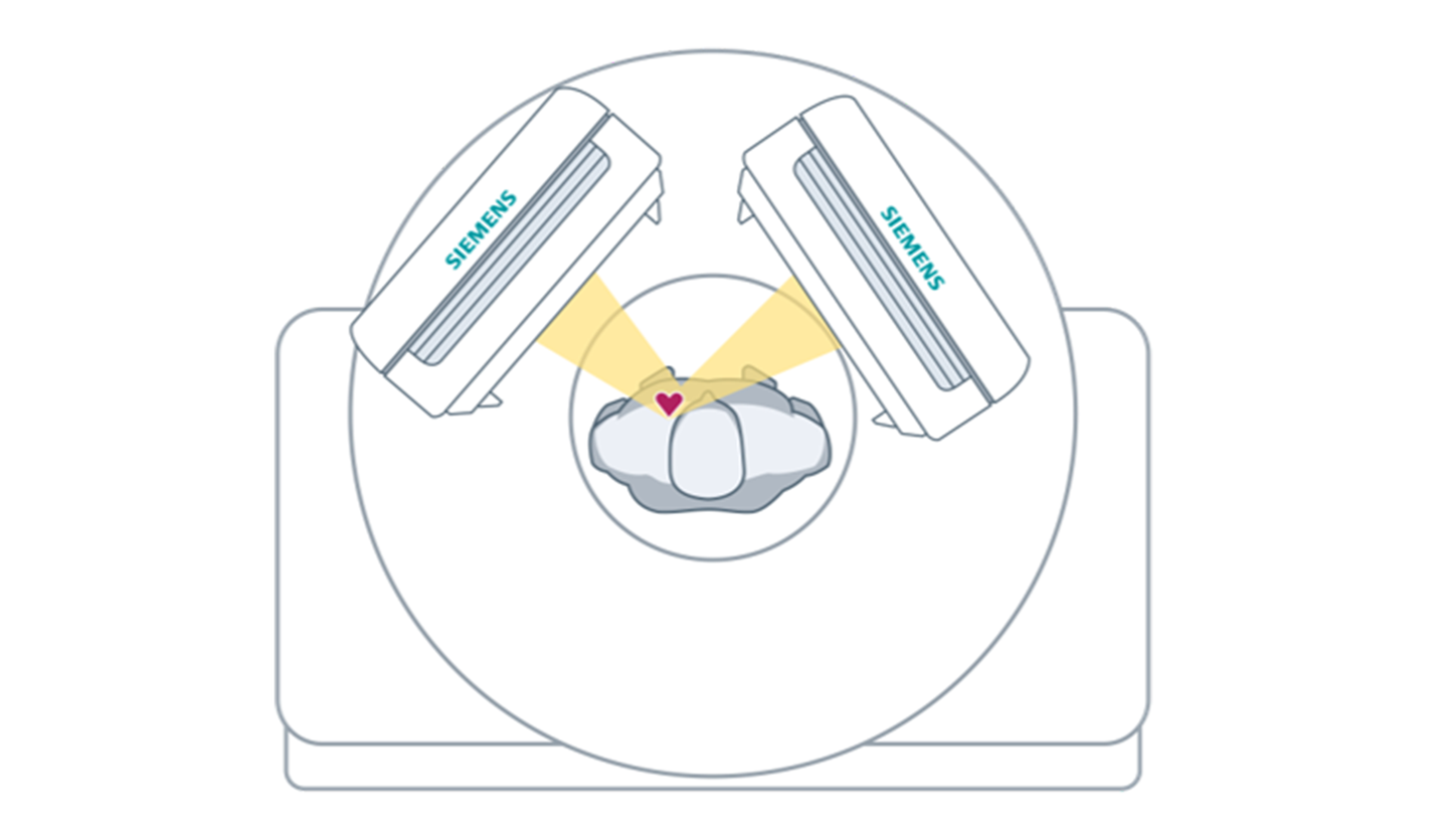 IQ•SPECT Technology
