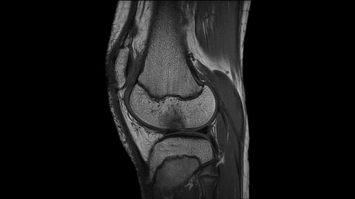 Pediatric MRI