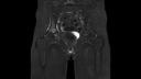 Pediatric MRI