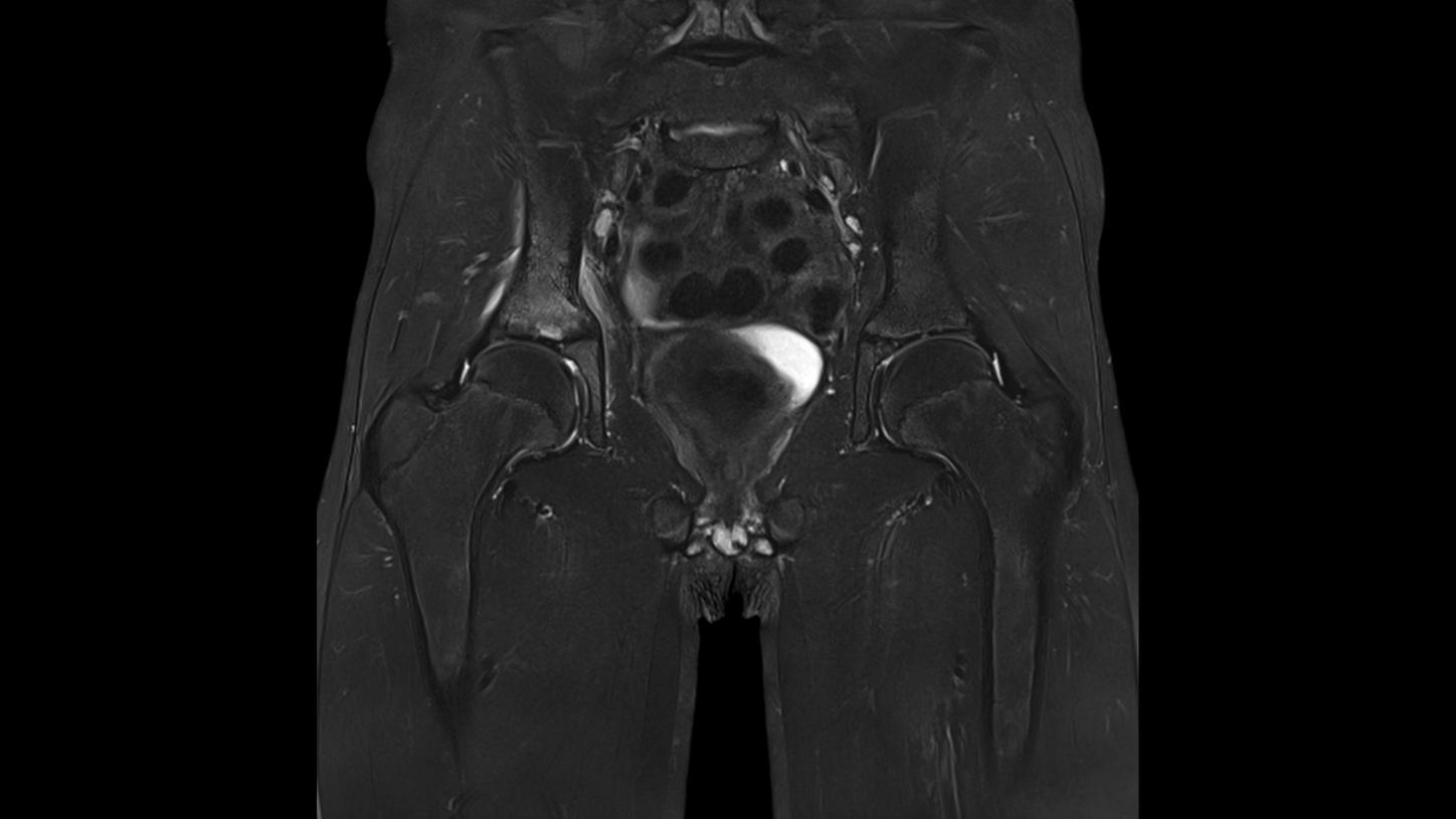 Pediatric MRI