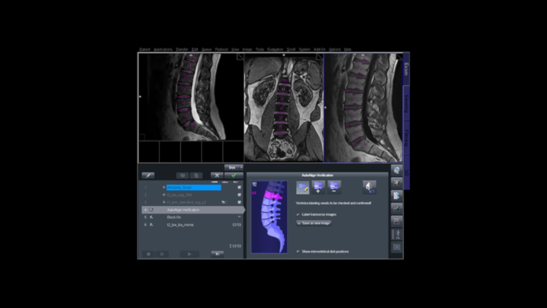 MR Neuro Imaging - MRI Neurology
