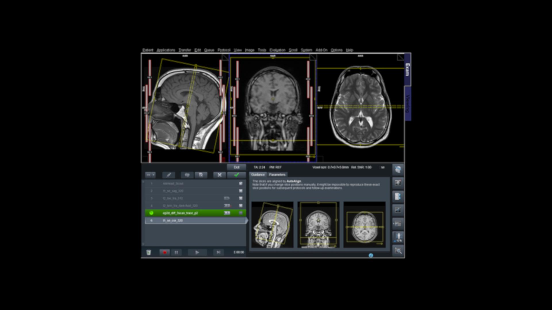 MR Neuro Imaging - MRI Neurology