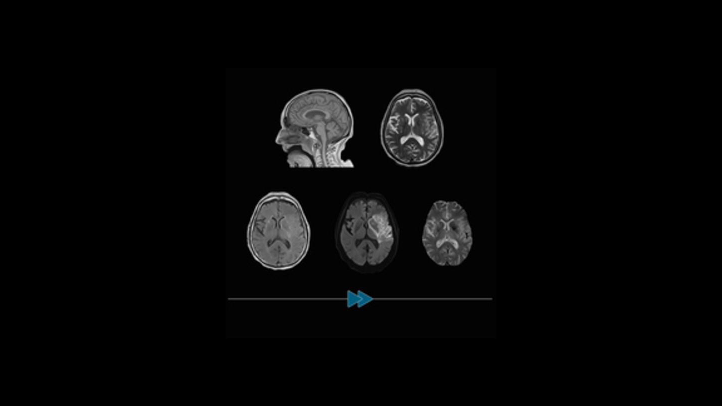 MR Neuro Imaging - MRI Neurology