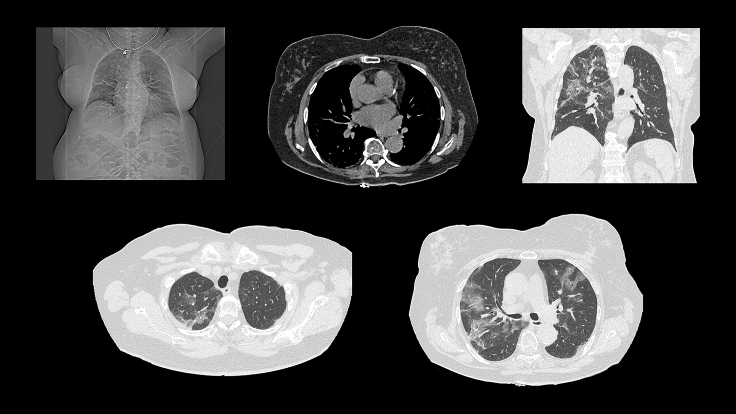 Our response to the COVID-19 pandemic