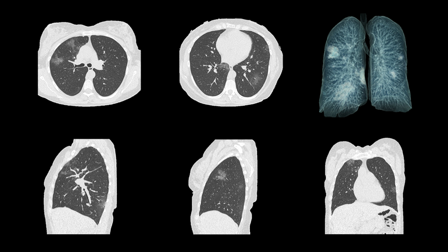 Our response to the COVID-19 pandemic