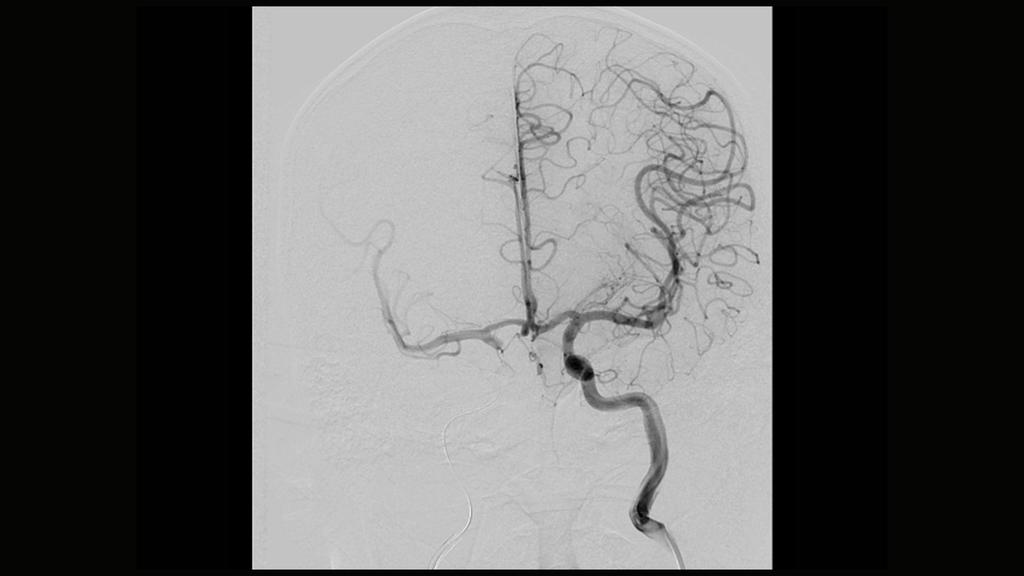 Neurosurgery