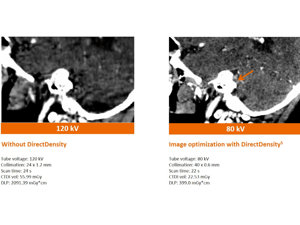 SOMATOM go. platform for Radiation Therapy