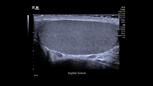 ACUSON Sequoia Ultrasound System