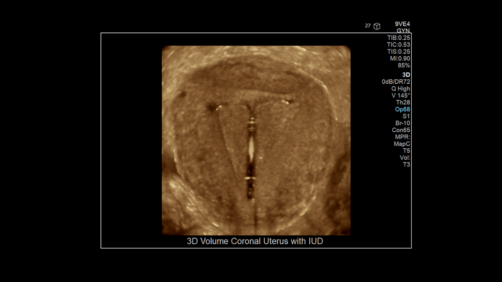 ACUSON Sequoia Ultrasound System