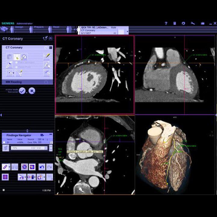 Computed Tomography - Clinical Software Applications