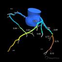 Rethink FFR assessment for every patient