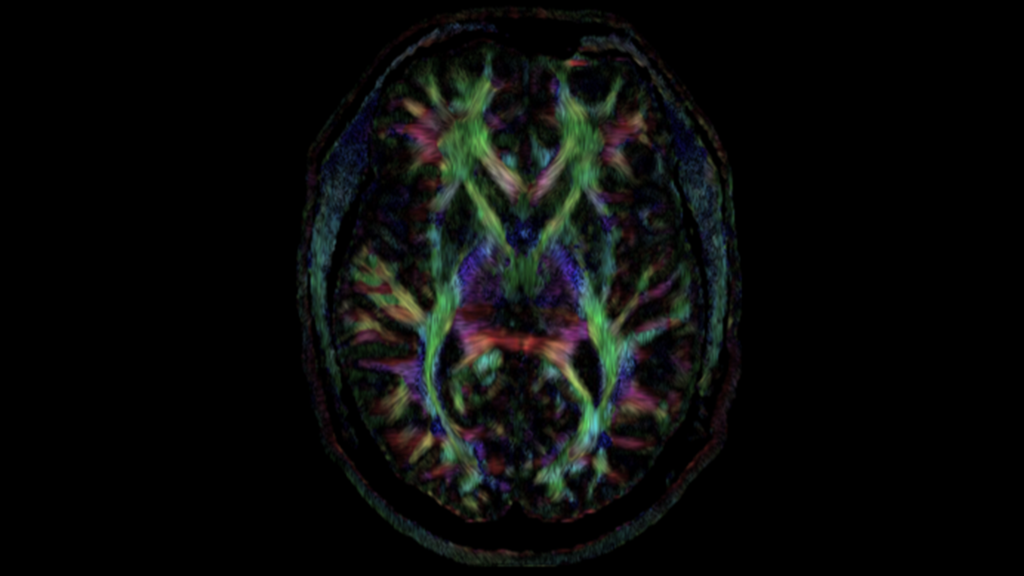 MAGNETOM Prisma - MRI Scanner