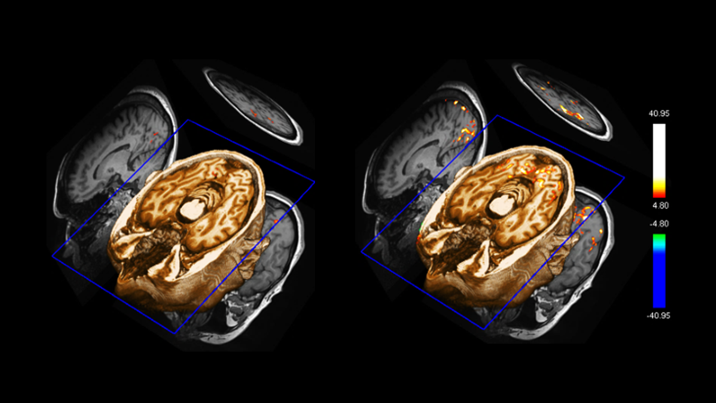 MAGNETOM Prisma - MRI Scanner