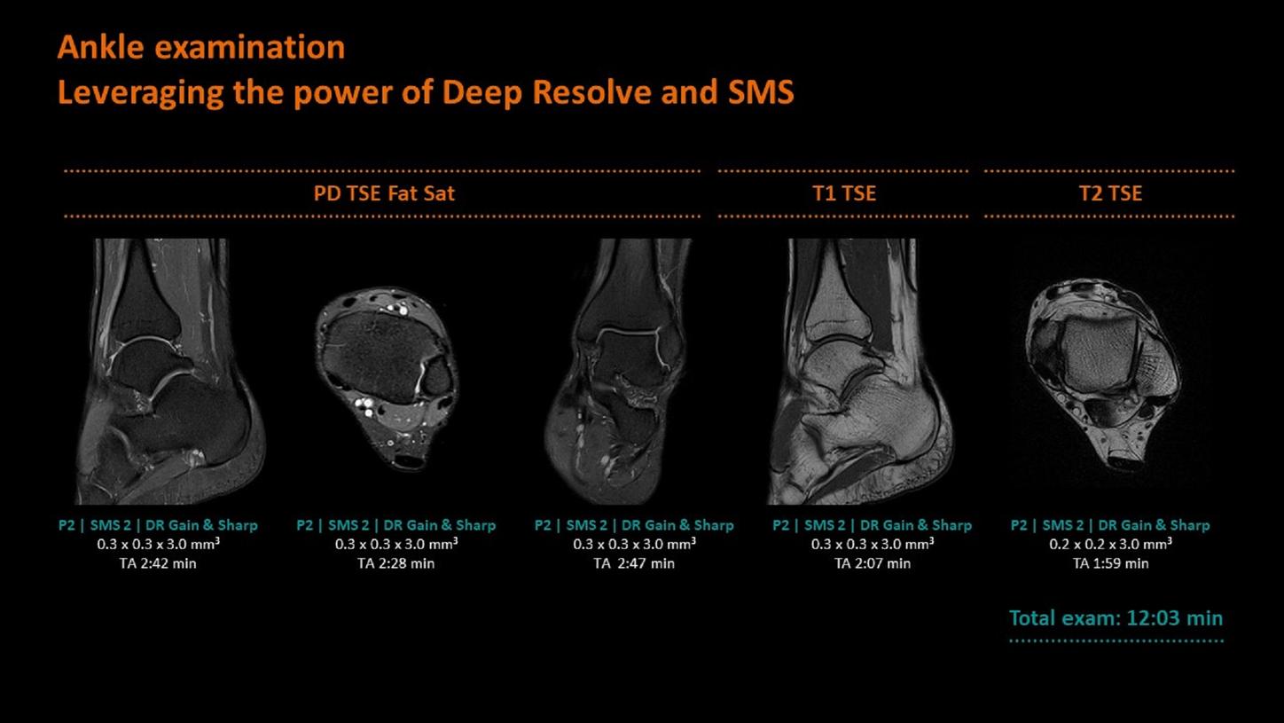 MAGNETOM Free.Max–wide bore mri