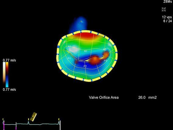 ACUSON SC2000 Ultrasound System Interactive Tour