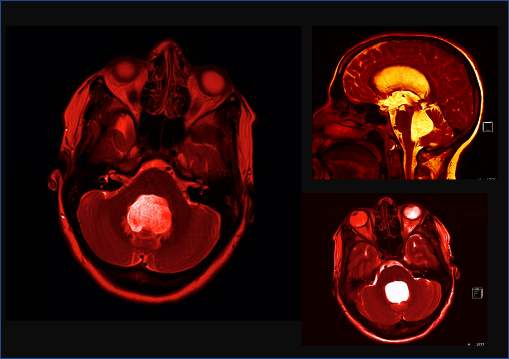 Introducing 3T MR Imaging with the New MAGNETOM Vida