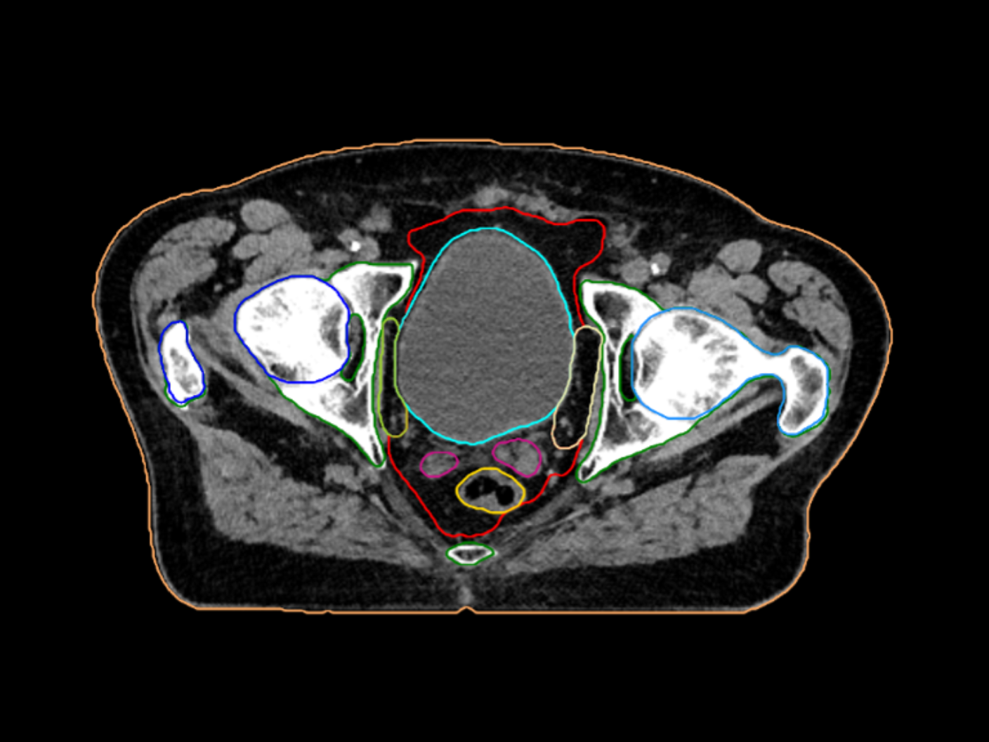 Imaging for Radiation Therapy