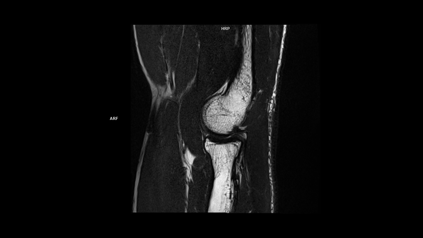 MAGNETOM Prisma - MRI Scanner