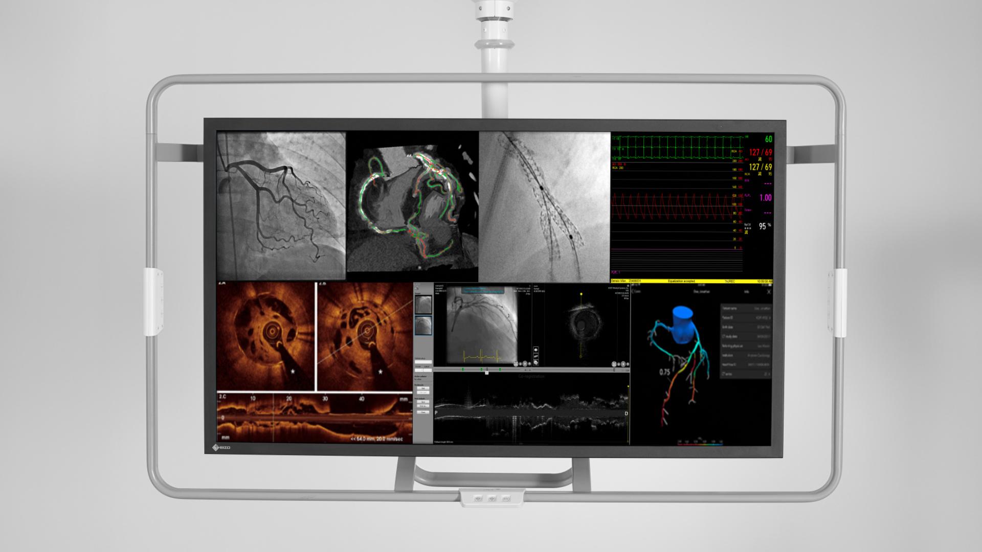 ARTIS icono – Angiography System – Siemens Healthineers