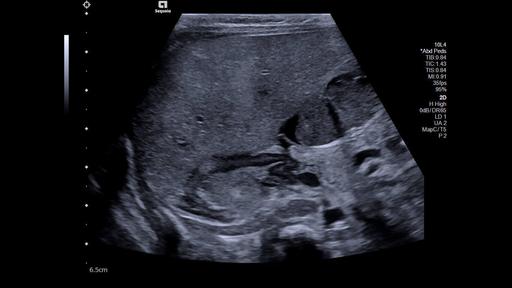 Pediatric Ultrasound System