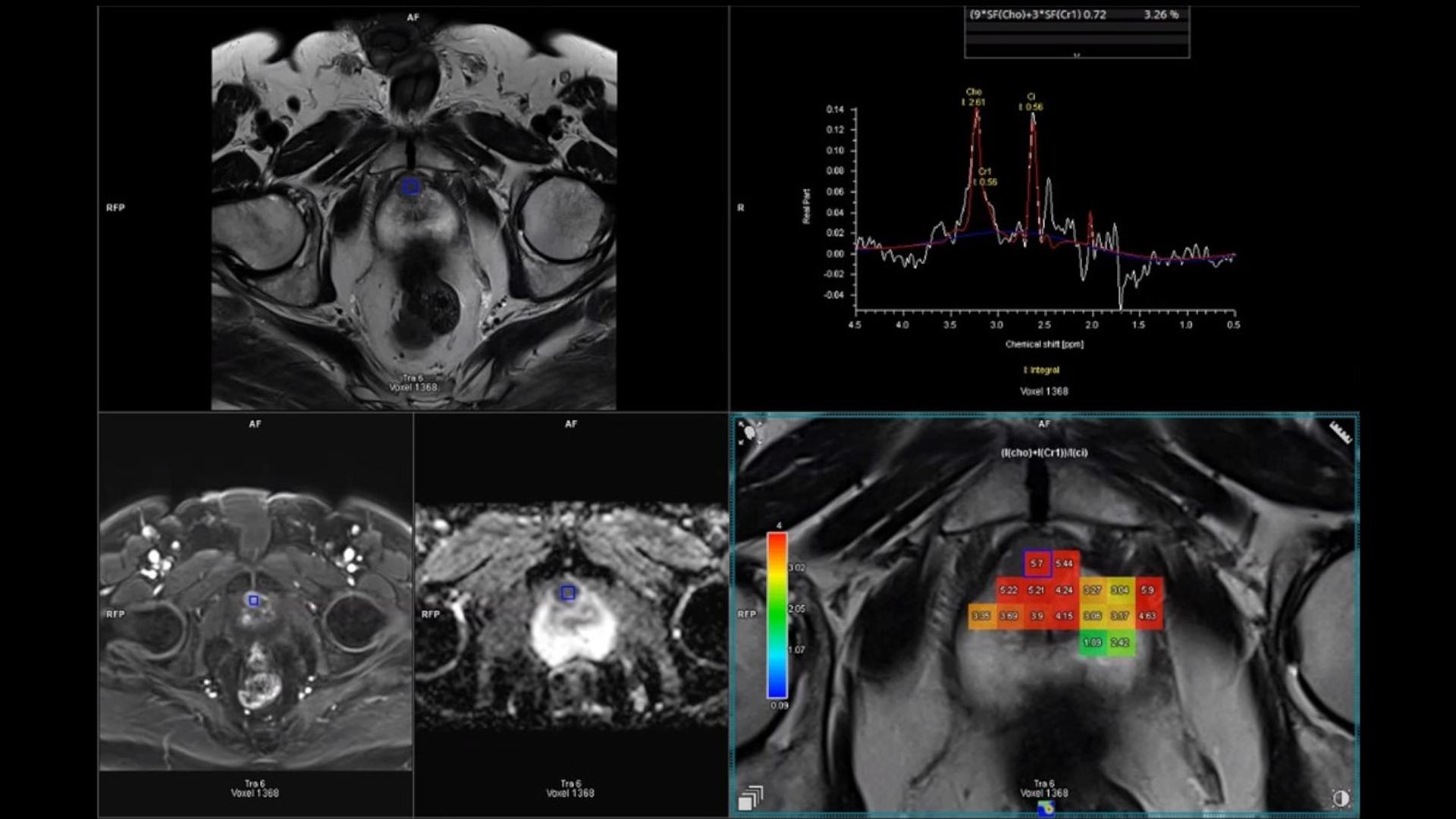 MAGNETOM Prisma - MRI Scanner