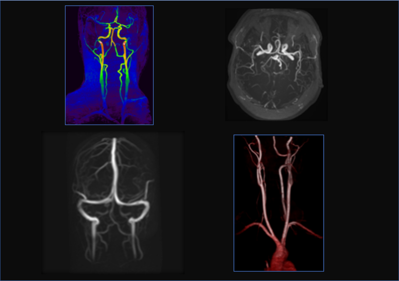 Introducing 3T MR Imaging with the New MAGNETOM Vida