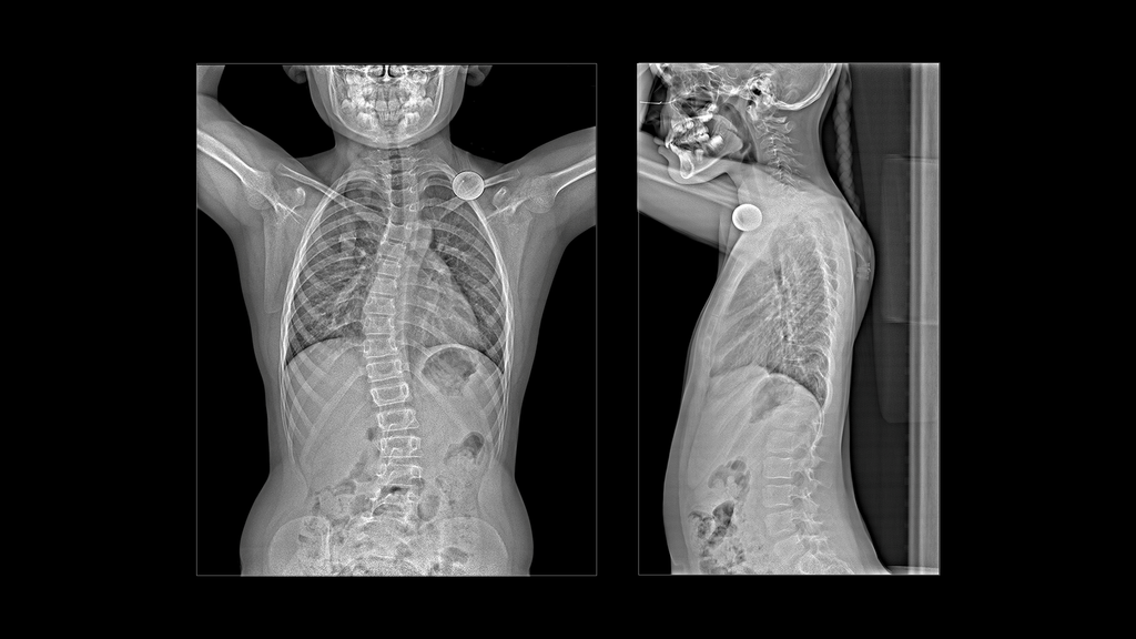 Twin Robotic X-ray scanner – Multitom Rax