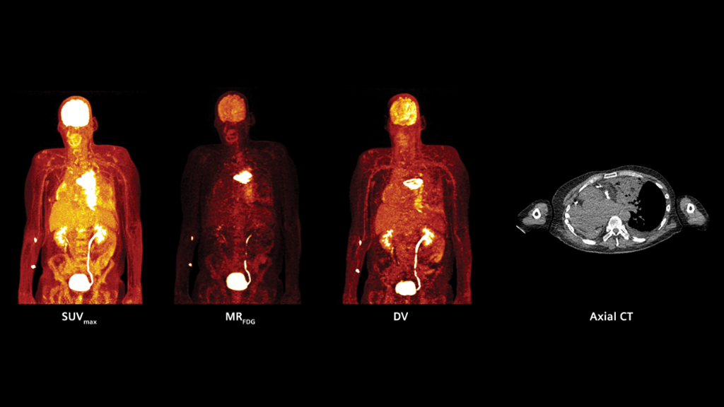 Siemens Healthineers Molecular Imaging clinical image galleries