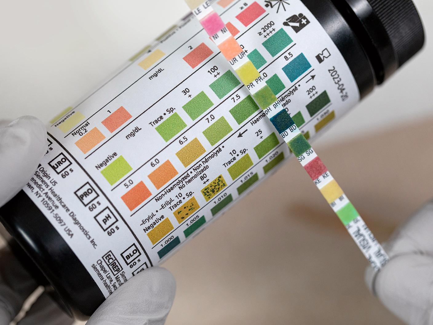 Point of Care Diagnostics