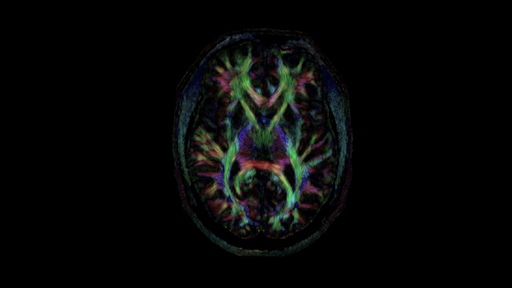 MAGNETOM Prisma - MRI Scanner