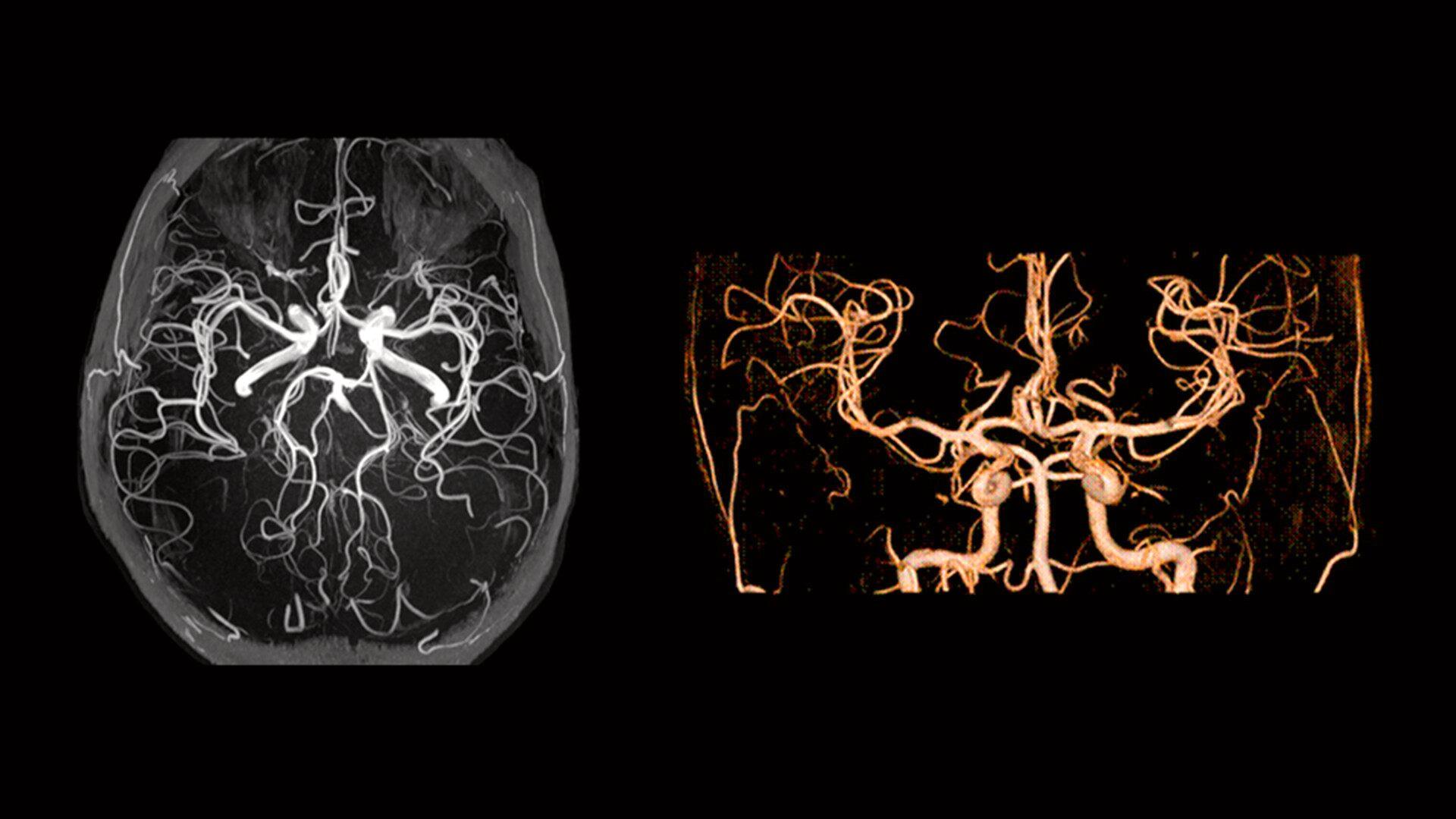 MAGNETOM Prisma - MRI Scanner